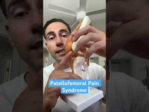 The truth behind your patellofemoral pain syndrome #shorts