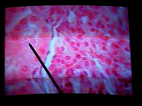 17. Kidney (400X) Pt. 2