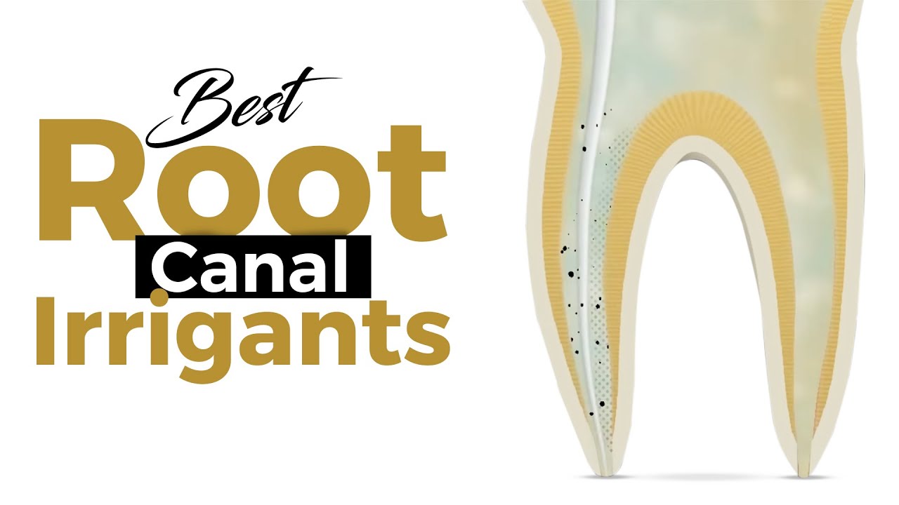 Best Root Canal Irrigants in Endodontic Treatment: Every Dentist Needs to Know