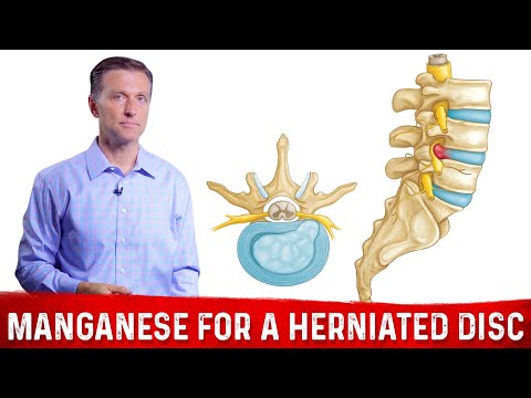 Take Manganese for Herniated Disc & Strengthening Ligaments – Dr.Berg