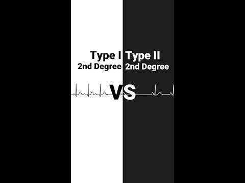 Second Degree Heart Blocks - Type I vs Type II