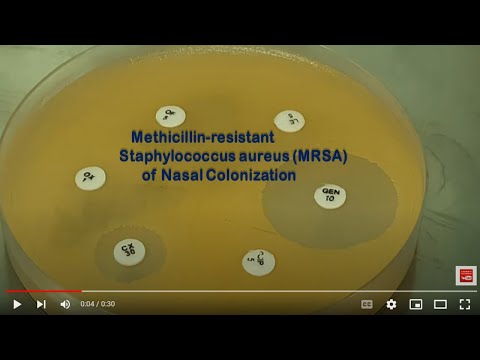 MRSA of Nasal Colonization| Nasal Swab Culture and Sensitivity