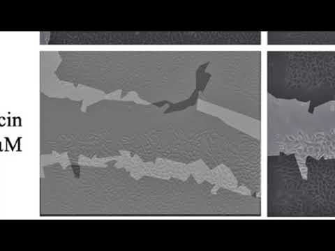 1B7106A5436237E2906615EC4A01F8#1