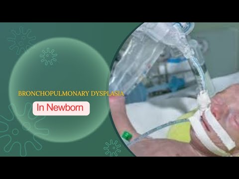 BRONCHOPULMONARY DYSPLASIA| CHRONIC LUNG DISEASE | DEFINATION| DR MEENA CHOUDHARY