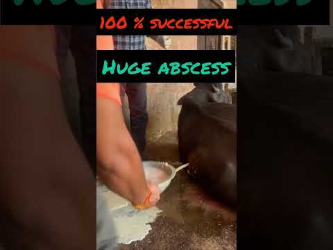 Huge abscess l Dr umar khan