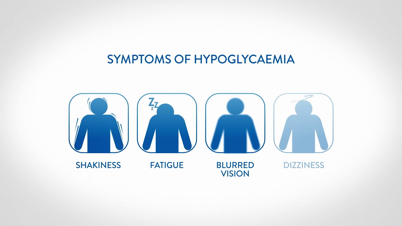 SmartGuard Explained