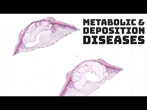 Metabolism & Deposition Diseases in Skin (dermatology dermpath pathology board review)