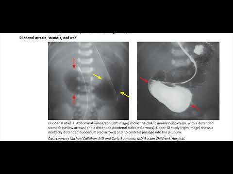Paediatric imaging from core radiology visuals ㅣradiopaedia @ctisus @navigatingradiology