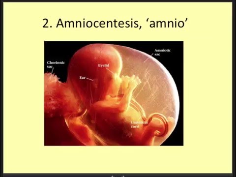 DAROGA Pregnancy. Antenatal Screening Part 2: fetal aneuploidy Trisomy 21 and 18
