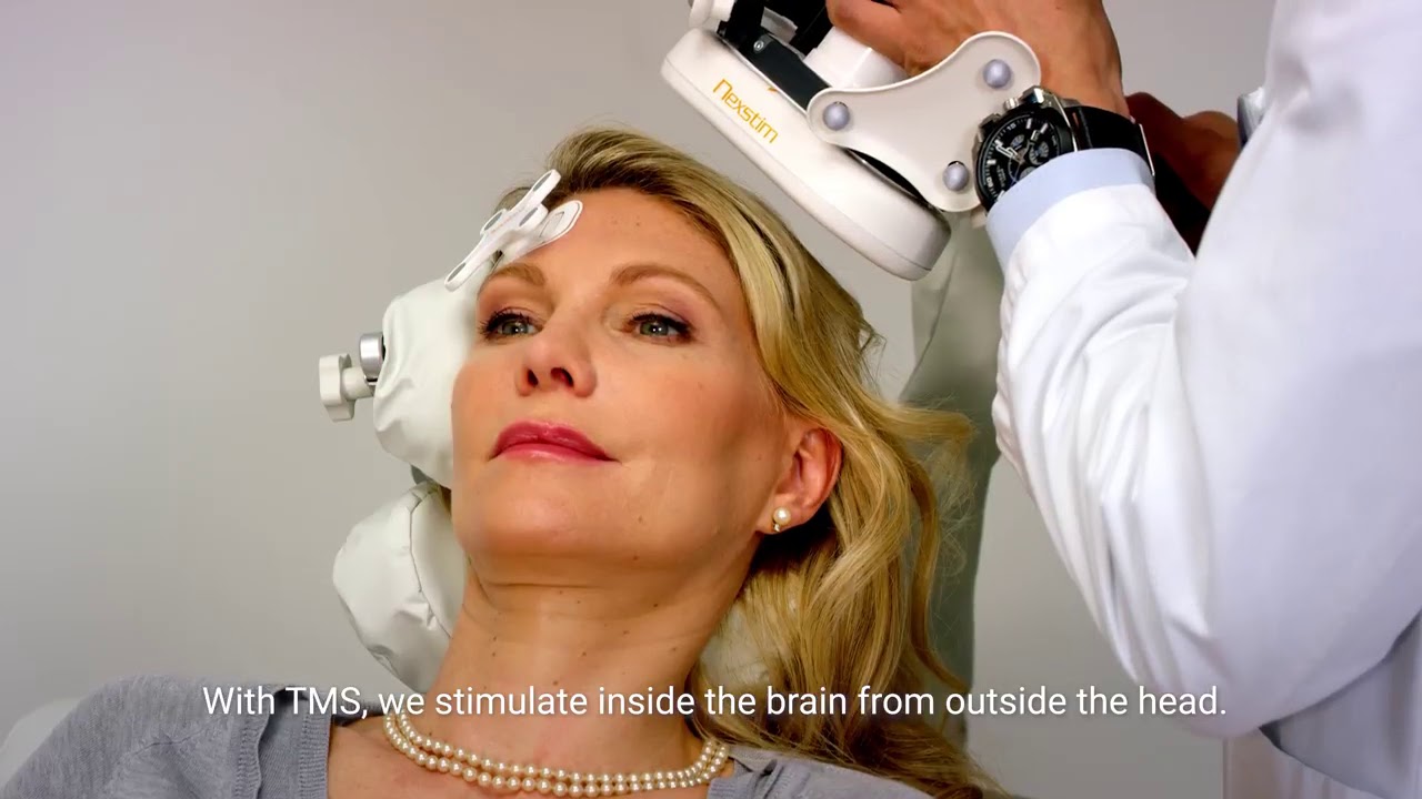 Nexstim SmartFocus™ TMS—a new therapy for depression 1