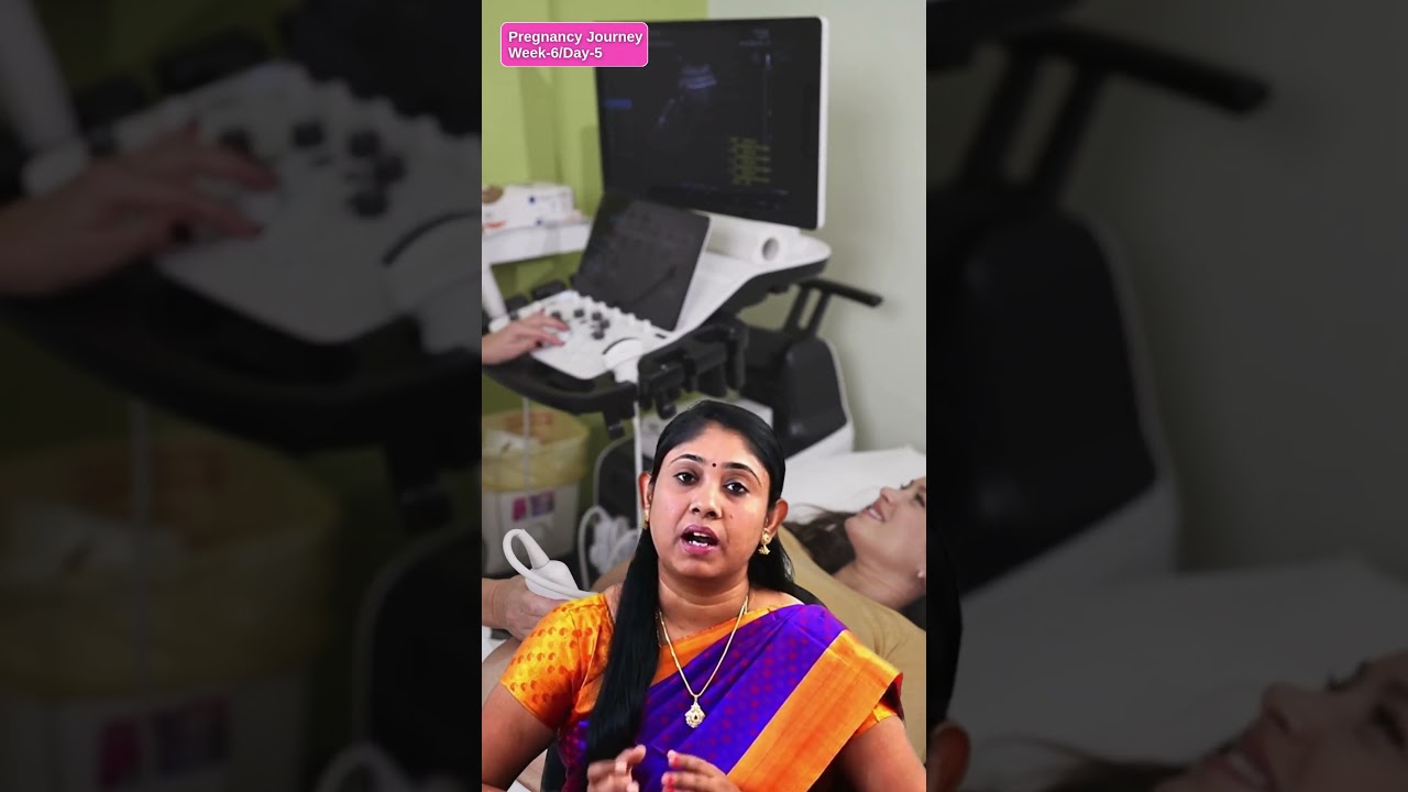 31. Viability Pregnancy Scan. 🍼✨ #MomentsThatMatter #ViabilityScan