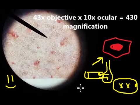 Simple squamous epithelium, Mark 2
