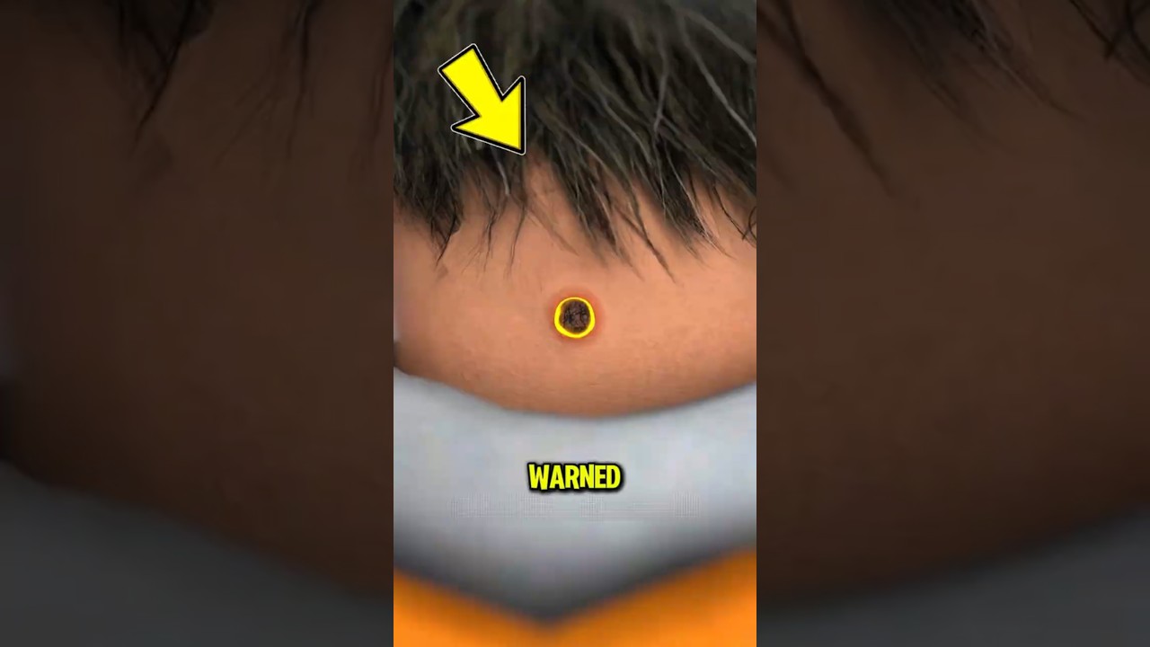 This Man Survived Cancer Because a Stranger Spotted It 😱📱