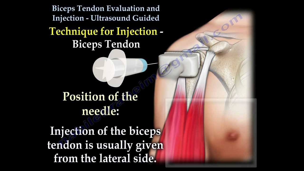 Biceps Tendon Evaluation, Injection Ultrasound  - Everything You Need To Know - Dr. Nabil Ebraheim