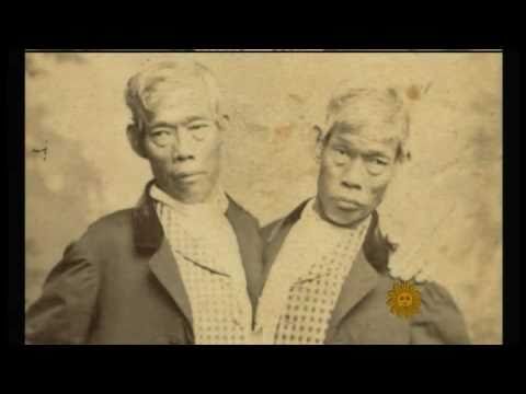 Chang and Eng Bunker, Siamese twin brothers.