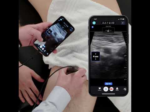 Ultrasound Education: The Femoral Vein