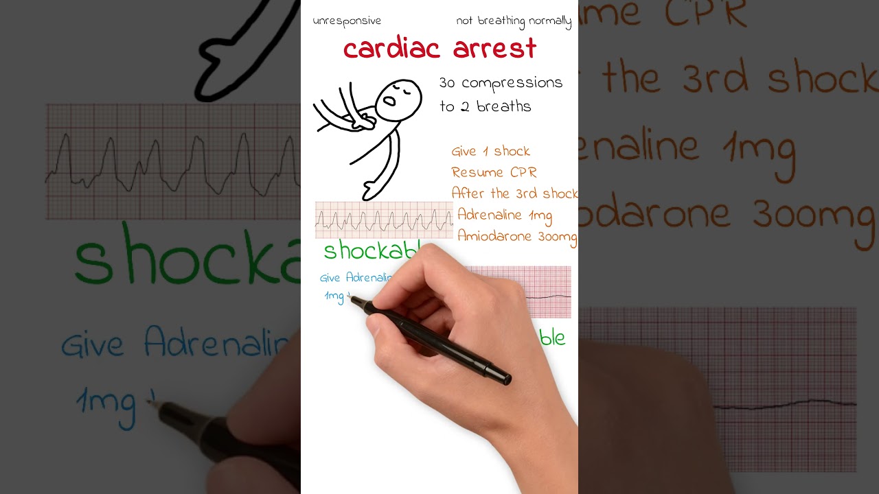 ALS Algorithm | Cardiac Arrest Resus Guide #imgdoctor #nhsjobs