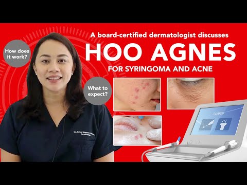 AGNES RF FOR SYRINGOMA AND ACNE