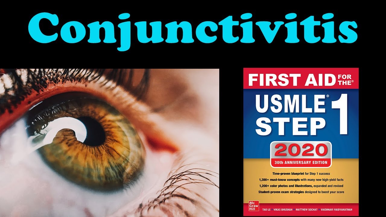 Conjunctivitis: Step 1 Review