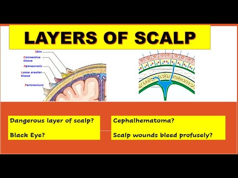 SCALP LAYERS AND CLINICAL ANATOMY – Anatomy QA