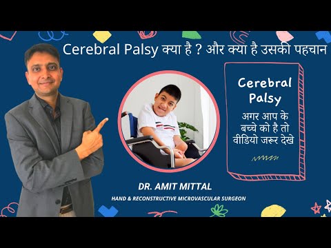 Cerebral Palsy (सेरेब्रल पाल्सी ) क्या है ? Symptoms & Treatment of Cerebral Palsy in Hindi