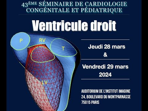 23 La prise en charge de l’insuffisance cardiaque est elle identique dans les ventricules droits sys