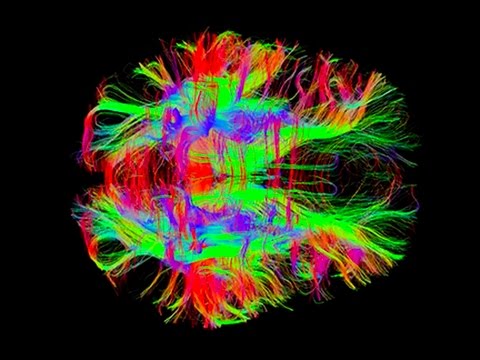 Drawing and the Brain