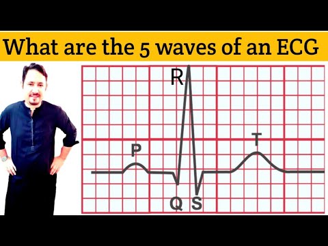 What are the 5 waves of an ECG In Urdu Hindi| ECG QRS complex | Explain ECG | EKG Waves |Irfan Azeem