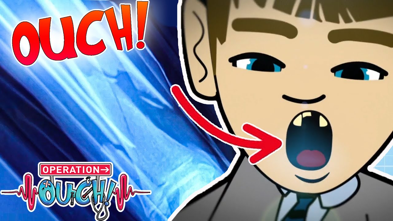 @OperationOuch - Broken Bones and Busted Teeth! | Science for Kids