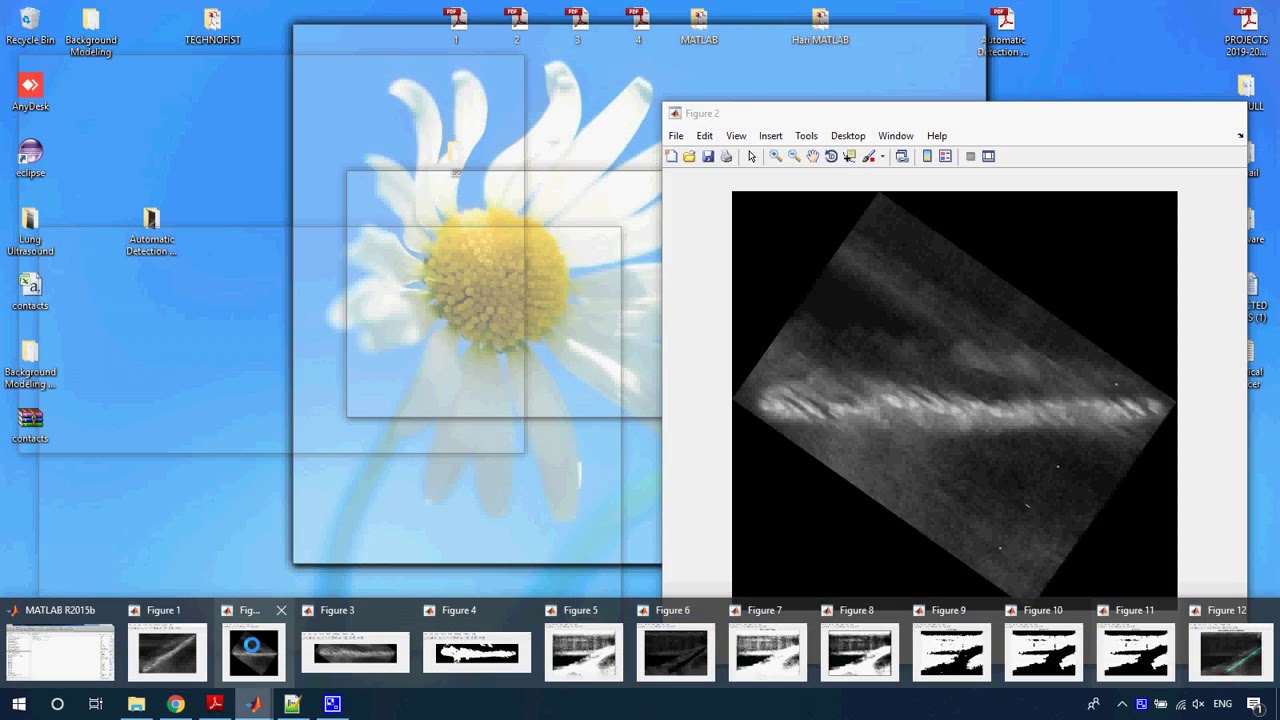 Automatic Detection of B lines in In Vivo Lung Ultrasound in Matlab ...