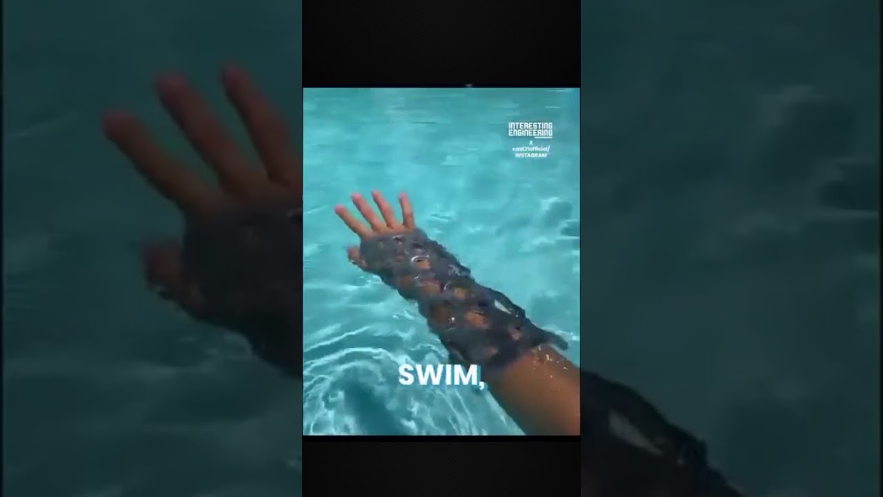 🚀 Adeus gesso, olá futuro da ortopedia! ✨