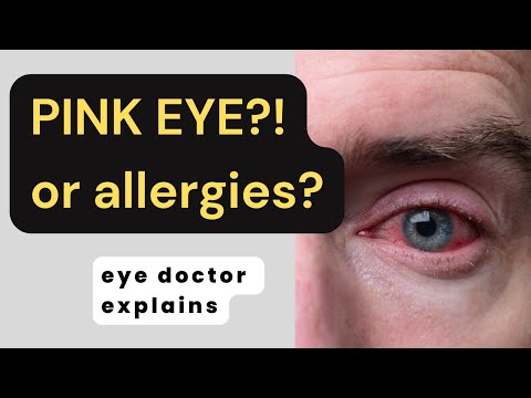 Eye Allergies vs Conjunctivitis | allergy eyes vs pink eye | allergic conjunctivitis |