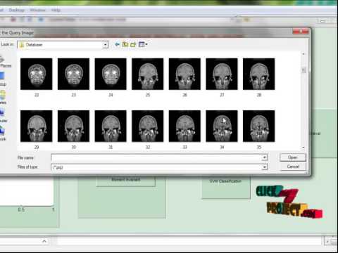 Final Year Projects | Content Based Image Retrieval For Medical MRI Brain Images