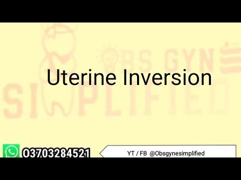 UTERINE INVERSION | @Obsgynesimplified