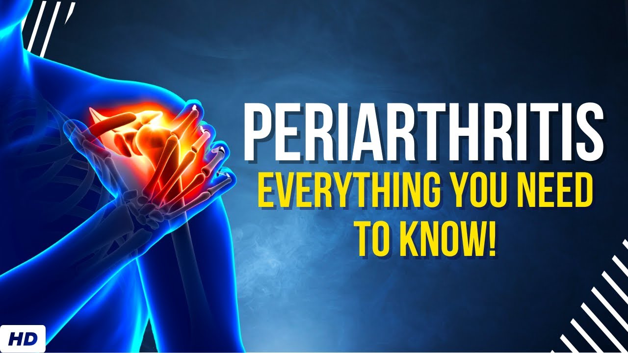 Periarthritis:  Everything You Need to Know