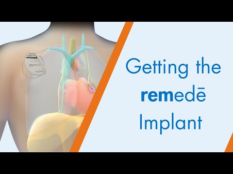 Getting the remedē® Implant - Patient Education Video