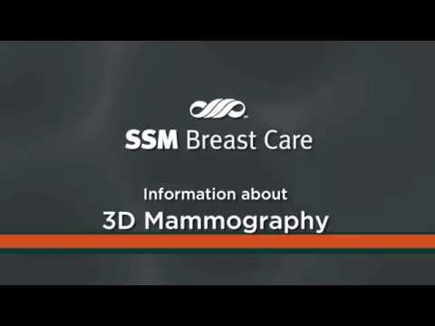 3D Mammography, Tomosynthesis | SSM Breast Care