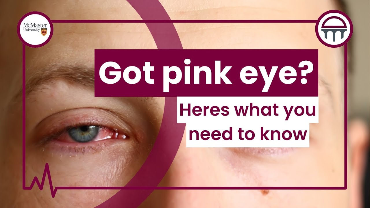 Conjunctivitis (Pink Eye): Explained