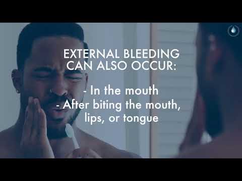 Signs and Symptoms of Bleeding in Hemophilia