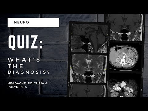 QUIZ - What's the Diagnosis? Headache, Polyuria and Polydipsia (Neuro)