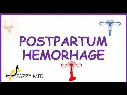 Postpartum Hemorrhage (PPH) causes,risk factors,prevention and treatment