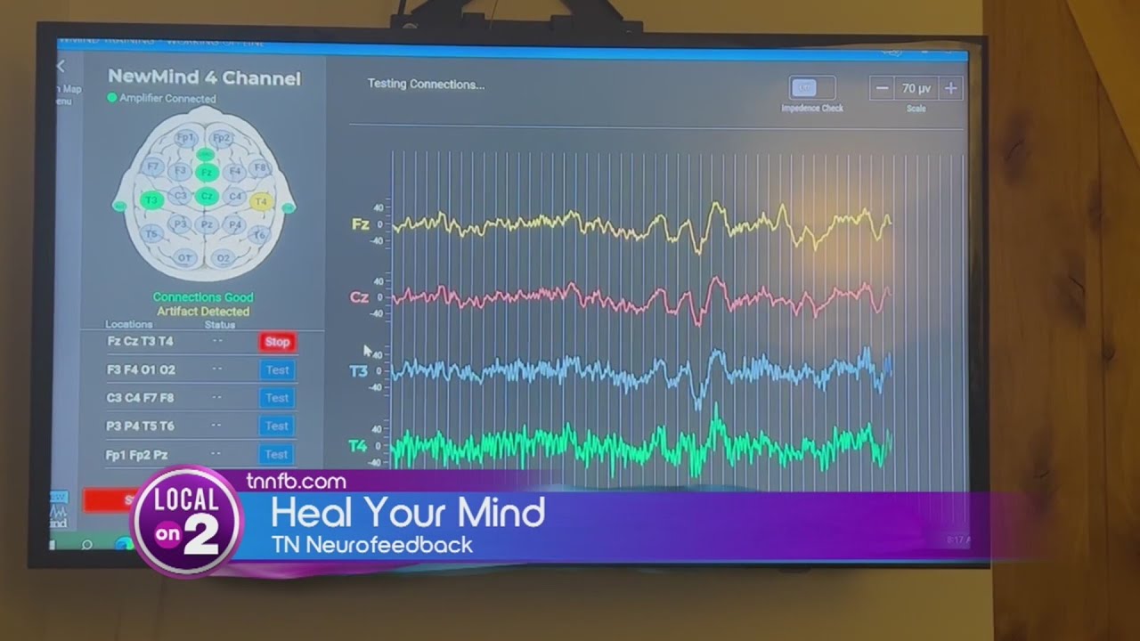 TN Neurofeedback: Train Your Brain