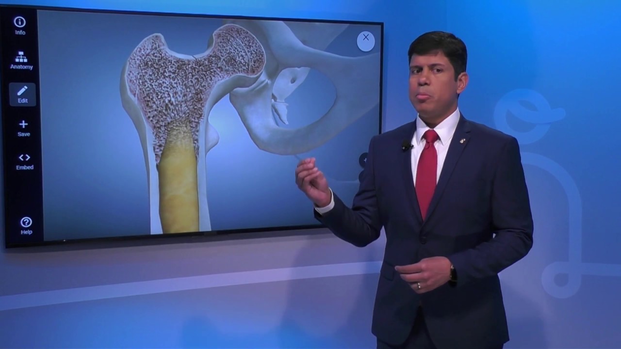 Osteoporosis, a Silent Disease