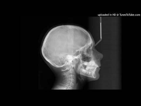 Jean Pierre Decerf - Radiologie Present