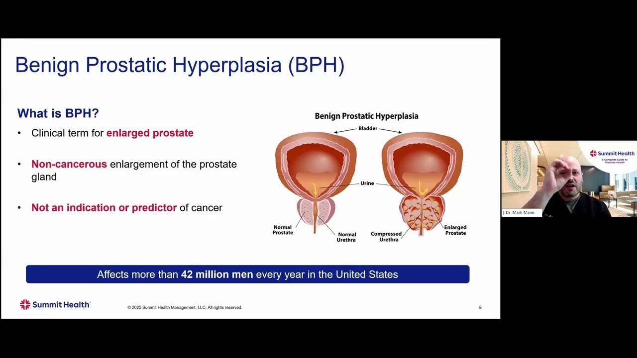 A Complete Guide to Prostate Health