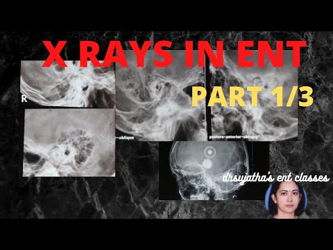 100. X ray classes for ENT Undergraduates Part 1/3 #medicalstudent #xrayclasses #mbbs