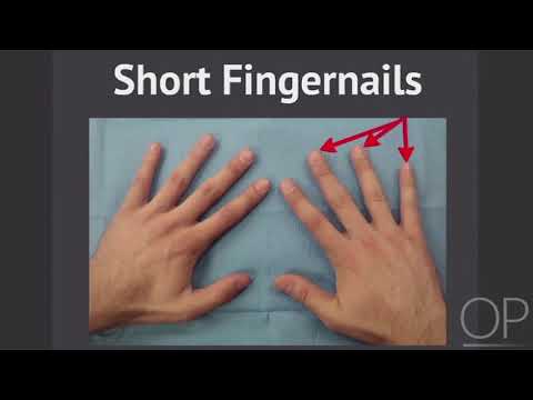 Infection Control & Bundles in the Medical Surgical ICU by D. Morrow | OPENPediatrics