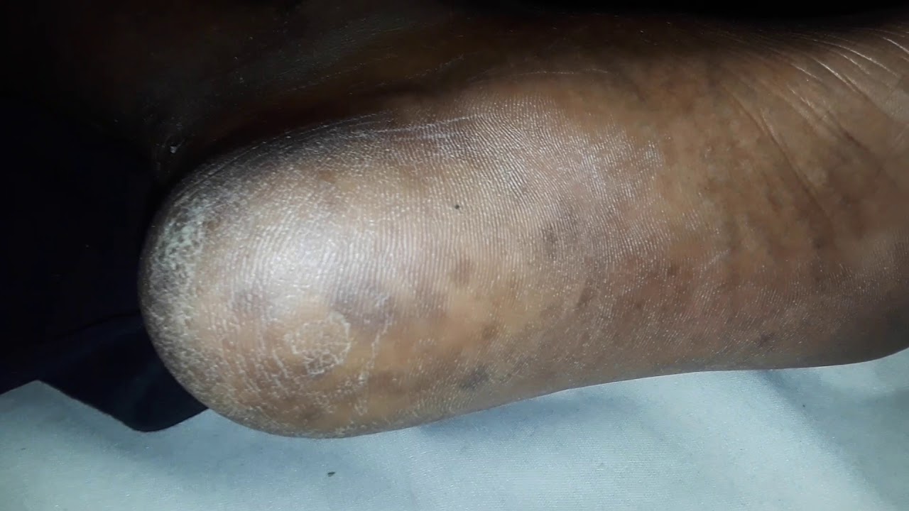 DRY AND DIRTY EBONY SOLES 2018