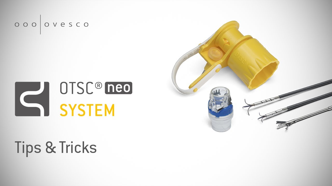 OTSC®neo System | Tips & Tricks