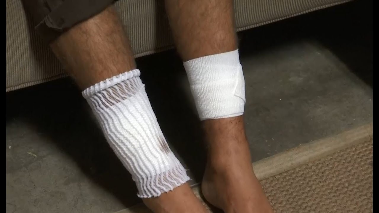 SHARK ATTACK: Surfer Nick Wapner talks about his narrow escape from a Great White Shark